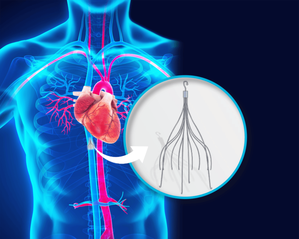 Inferior Vena Cava (IVC) - New England Endovascular Center